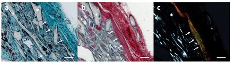 Ectopic Bone Formation By Stro 1 Hbmsc Cells On Implanted P3hbha Download Scientific