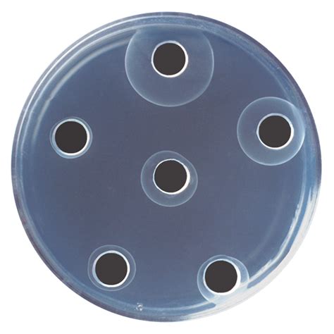 Radial Immunodiffusion Wikipedia