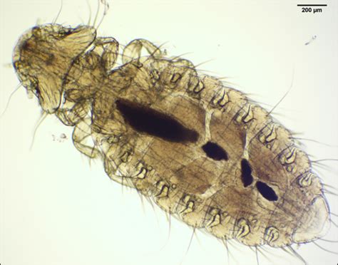 Louse Identification Key
