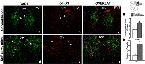 Coronal Sections Through The Paraventricular Nucleus Of Thalamus Pvt