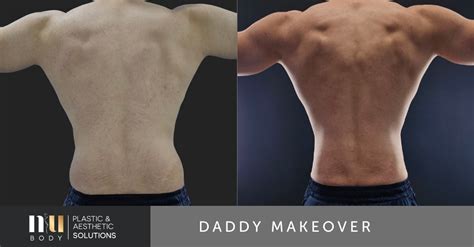Galería Daddy Makeover En Monterrey Nubody