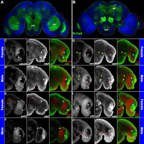 Sex Specific Expression Patterns Of Dets In The A Aegypti Pupal Brain