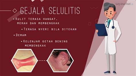 Selulitis Youtube
