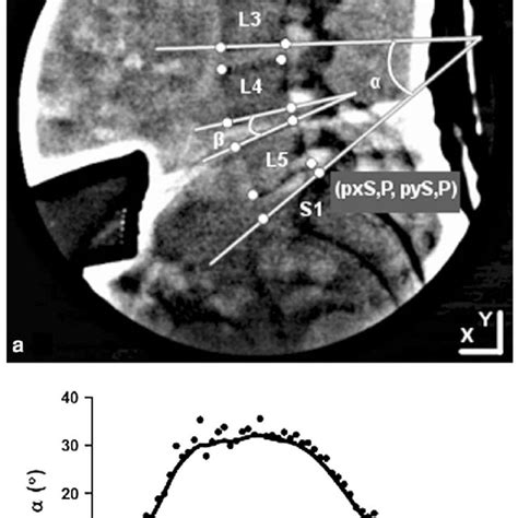 A Representative Fluoroscopic Frame With Labeled Anatomy Vertebral