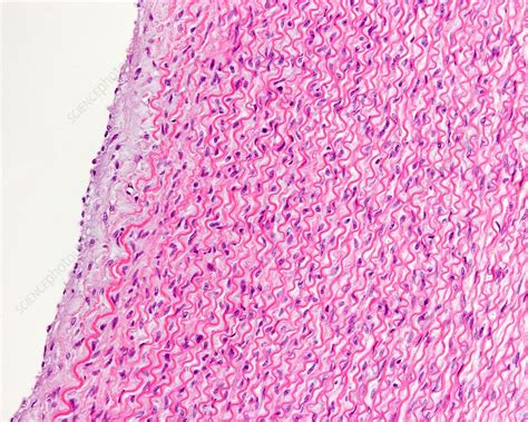 Elastic Artery Light Micrograph Stock Image C0361241 Science