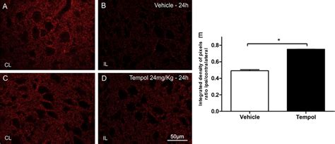 Immunohistochemistry Anti Synaptophysin In The Ventral Horn Of The