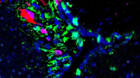 More Mayo Neuroscience Brain Cells Crosstalk And Cancer Growth