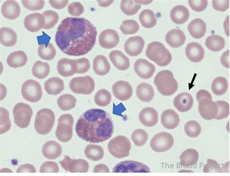 What Is The Normal Range Of Eosinophils In The Blood