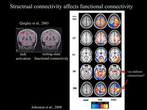 Ppt Resting State Fmri Powerpoint Presentation Free Download Id