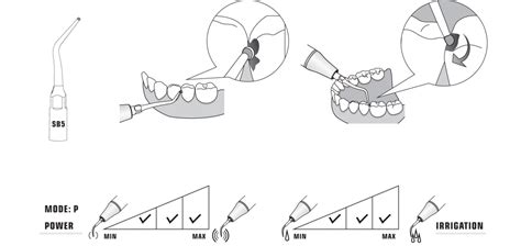 Sb5 Sbd5 Sunny Dental Medical Supply