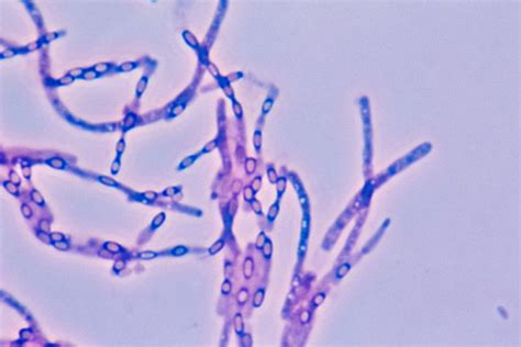 This Vaccine Can Protect You From Anthrax—after Exposure Wired
