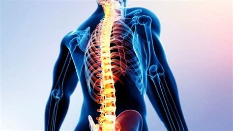 Permanent Restrictions After A Spinal Fusion Get To Know