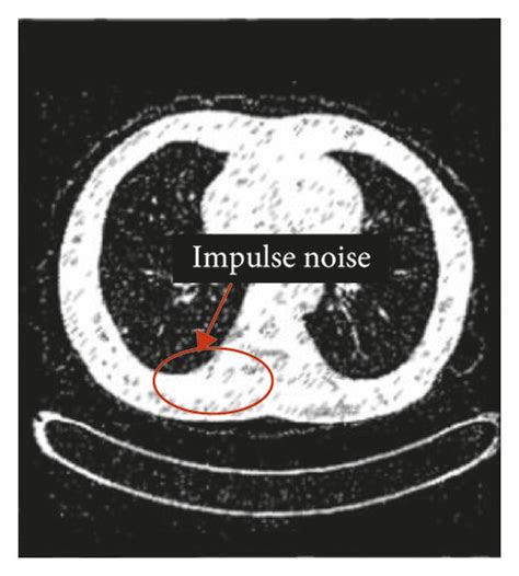 median filtering example a original lung ct images b median
