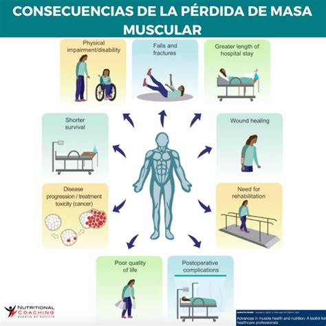 Consecuencias De La Pérdida De Masa Muscular Nutritional Coaching