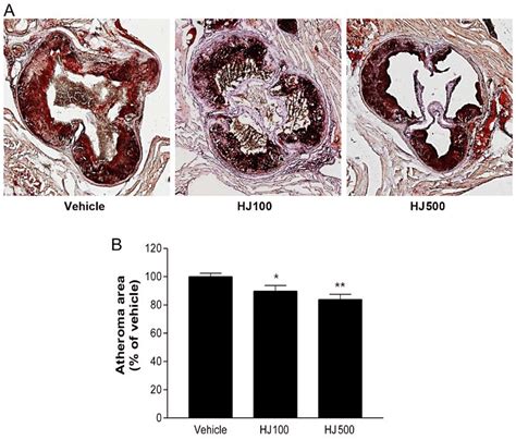 Effect Of H Japonicus Hj On The Formation Of Atherosclerotic Plaques