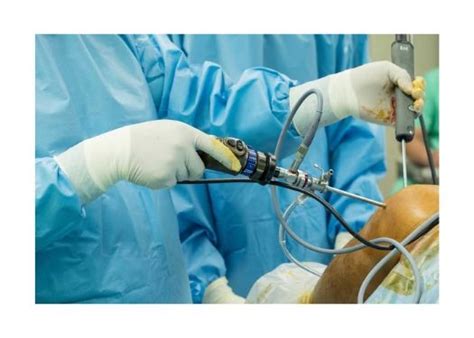 Arthroscopic Shoulder Surgery Shoulder Specialist South Windsor
