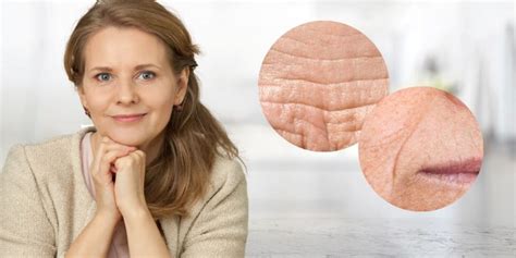 Botox de graça e fim as rugas Misturinha 2 ingredientes