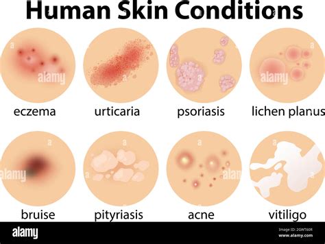Skin Condition