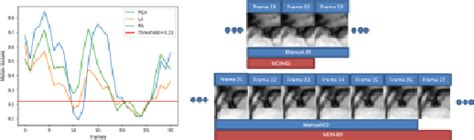 Figure 1 From Automatic Cardiac Resting Phase Detection For Static