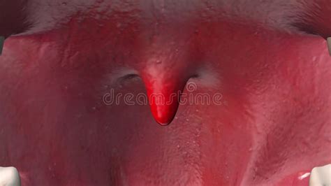 Close Up Of Swollen Uvula Inside Mouth Stock Footage Video Of Swollen