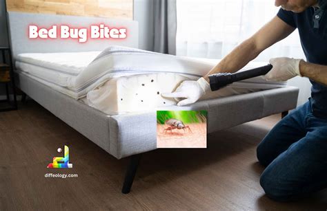 Difference Between Bed Bug Bites And Mosquito Bites Diffeology