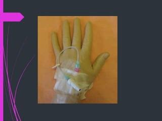 Iv Infusion Ppt PPTX