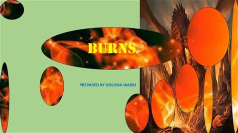 Burns Calculation Of Burns Calculation Of Fluid Requirement And Management Pdf