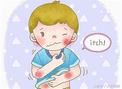 健康天天測，疥瘡應該如何處理和預防？ 每日頭條