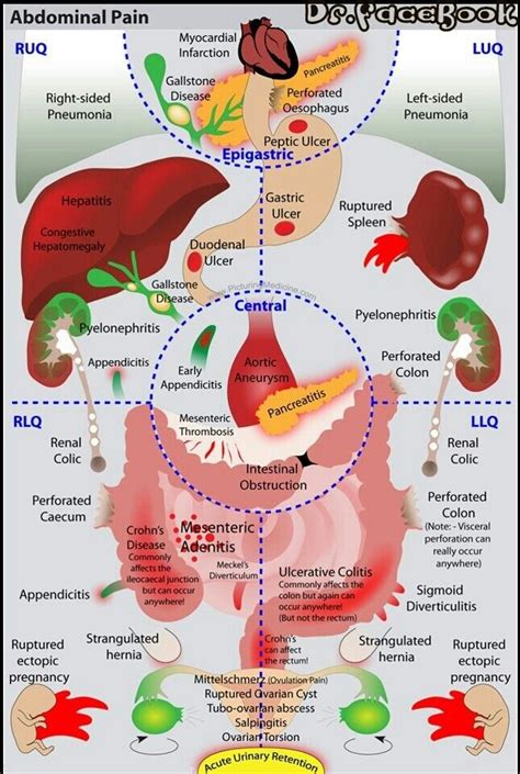 Diagram Female Abdominal Pain Diagram Mydiagramonline
