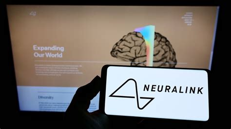 Neuralink Comenzará Pruebas De Implantes De Cerebros En Humanos Antes