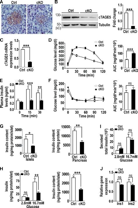 Figure 1 From Ctage5 Deletion In Pancreatic β Cells Impairs Proinsulin