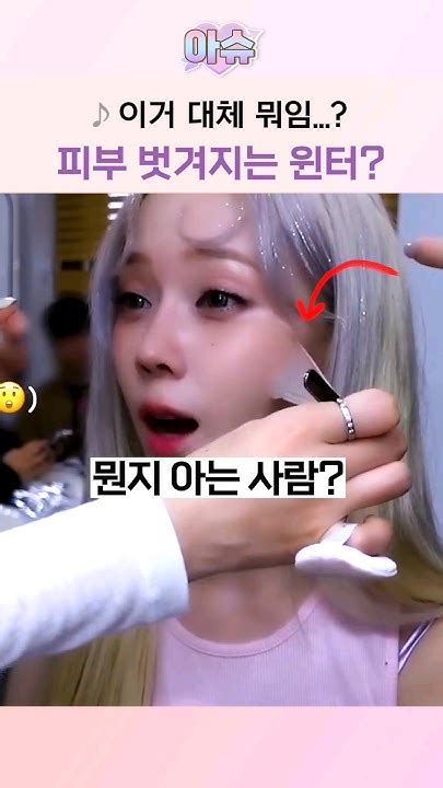 이거 대체 뭐임 피부 벗겨지는 윈터 Youtube