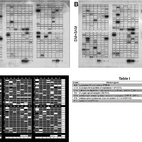 microarray analysis of gene expression in cns a representative array