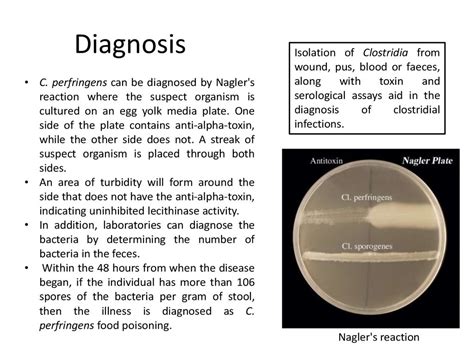 Clostridium Perfringens презентация онлайн