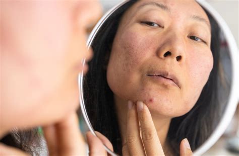 Best Hair Growth Vitamins And Supplements For Men Foundation Skincare