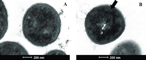 Transmission Electron Microscope For S Aureus Strain Pb36 Mrsa
