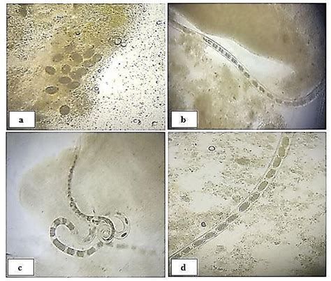 Adult Females Of Capillaria Sp A Sever Concentrations Of Peanut
