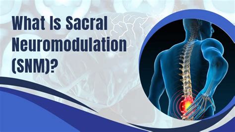 Dr Chirag Solanki On Linkedin What Is Sacral Neuromodulation Snm