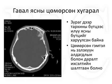 Тархины компьютер томографи Ppt Download