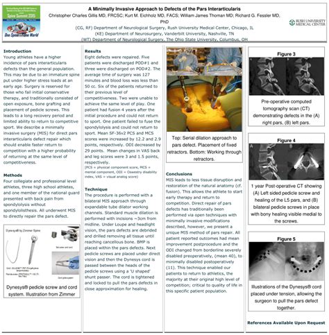 Pdf A Minimally Invasive Approach To Pars Defect Repair