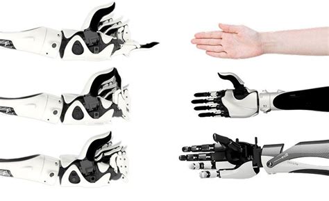 Exiii Hackberry An Open Sourced D Printed Bionic Hand Nanotechnology Prosthetics Medical