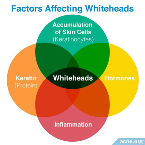 What Is A Whitehead Acne Org