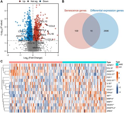 Bioinformatics Analysis For Constructing A Cellular Senescence Related Age Related Macular