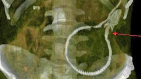 Eel Put In Butt Youtube