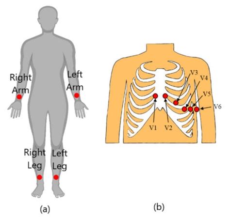 Sensors Free Full Text Electrocardiogram Based Emotion Recognition Systems And Their