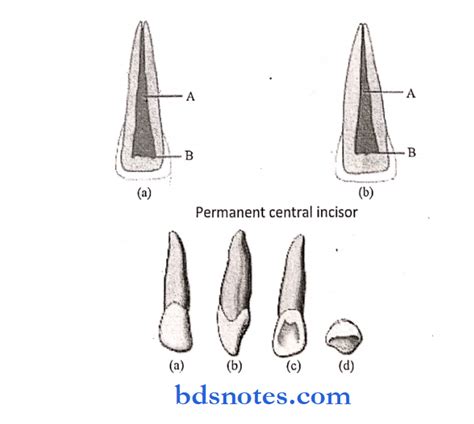 Primary Deciduous Teeth Question And Answers Bds Notes