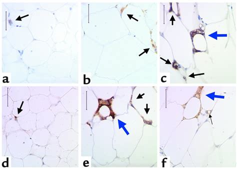 JCI Obesity Is Associated With Macrophage Accumulation In Adipose Tissue