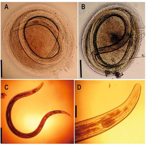 Some Digenetic Trematodes Infecting Anurans From Ase Creek A D Fi