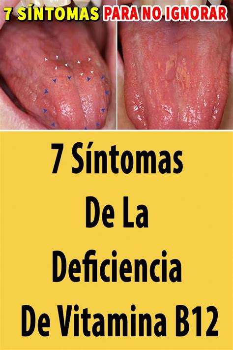 7 Síntomas De La Deficiencia De Vitamina B12 Nunca Deben Ignorarse