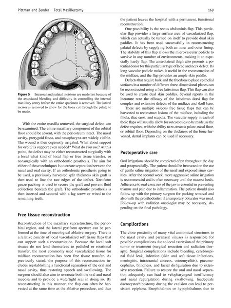 Total Maxillectomy Pdf